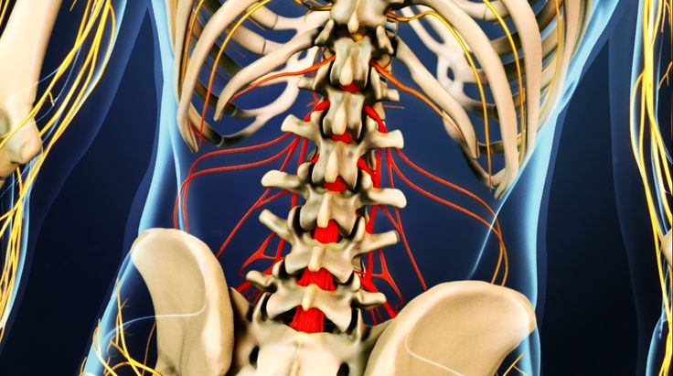 LUMBALGIAA - Instema, Formación para fisioterapeutas